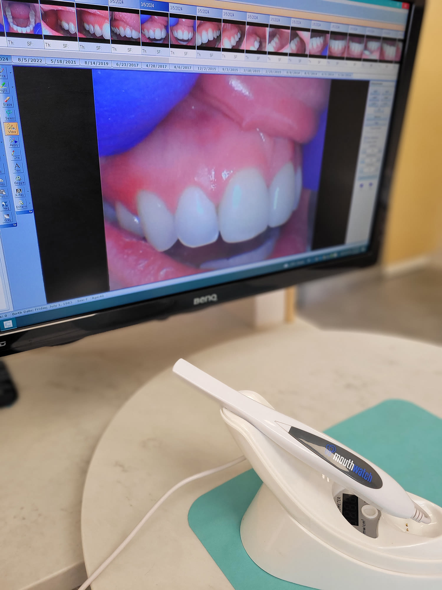 Intra-Oral Cameras | Northwest Dental | General & Cosmetic Dentist in ...