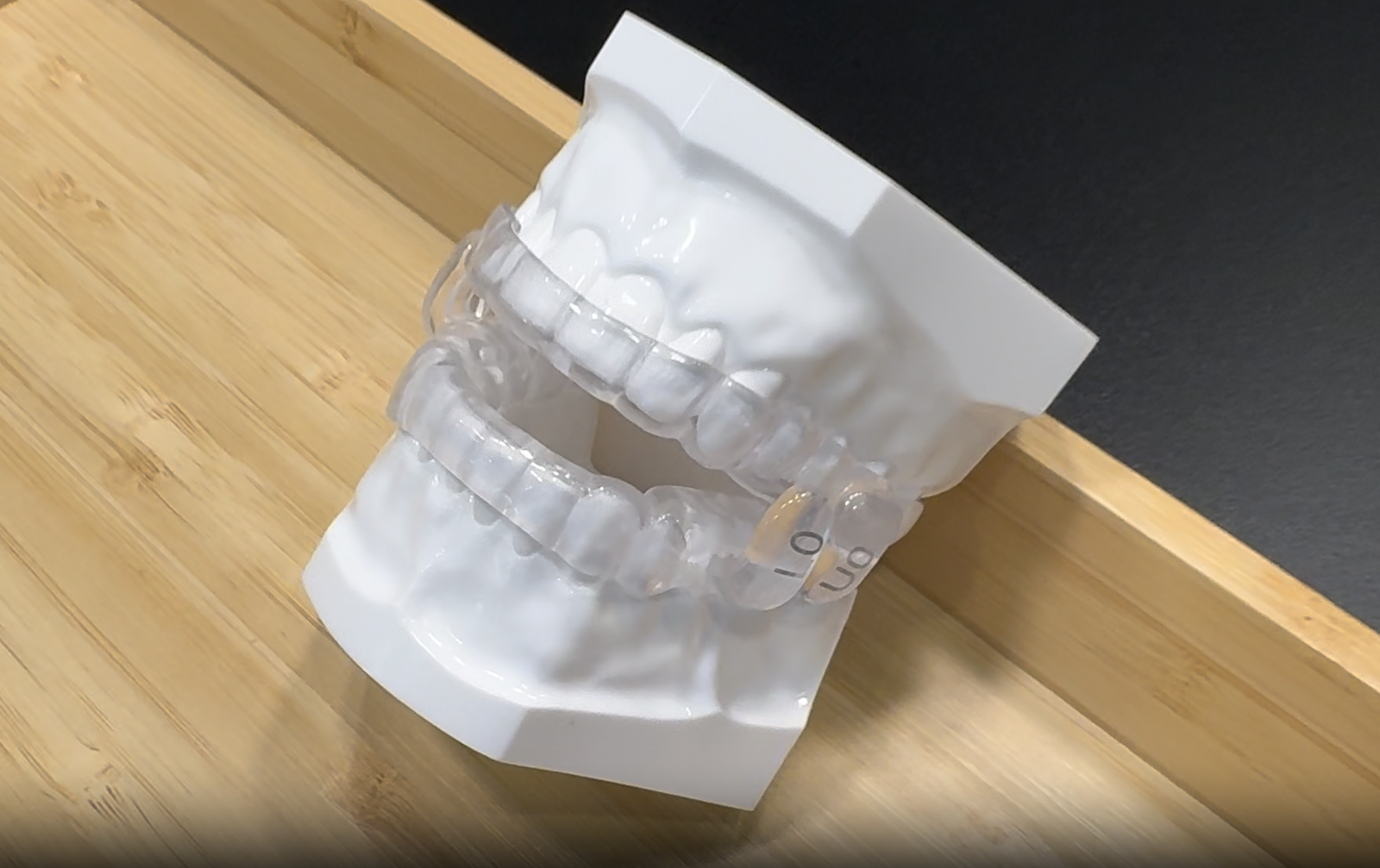 5 Benefits of an Oral Appliance for Better Sleep & Health